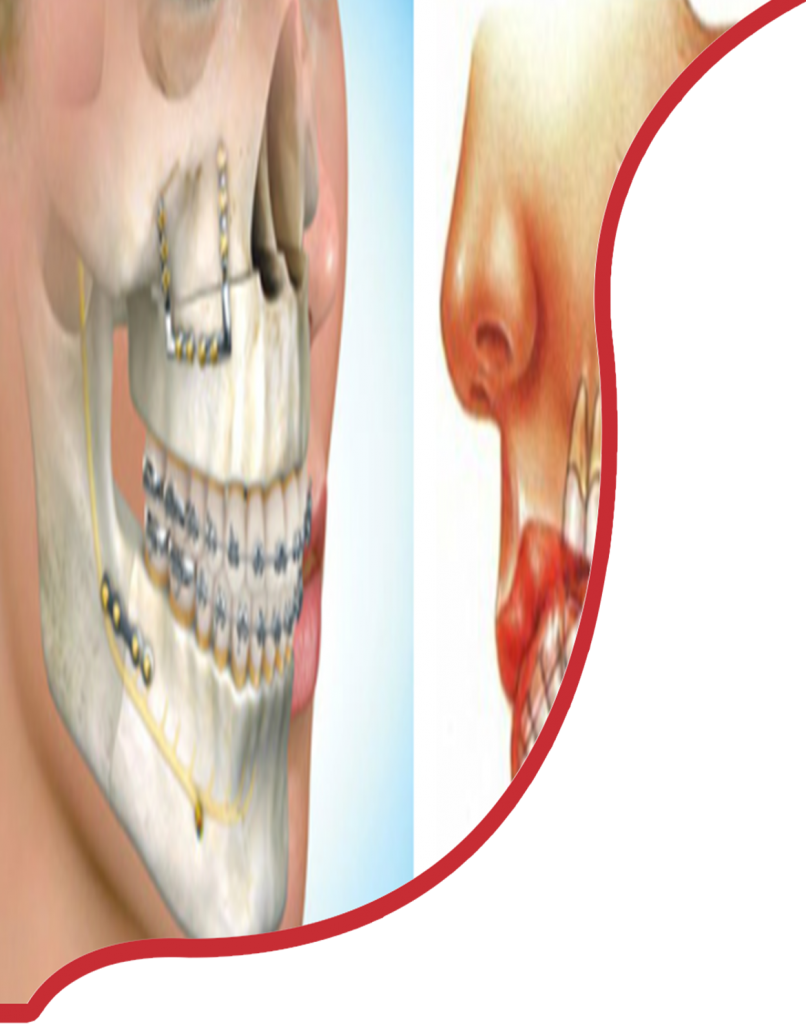 Maxillo Facial – Medicare